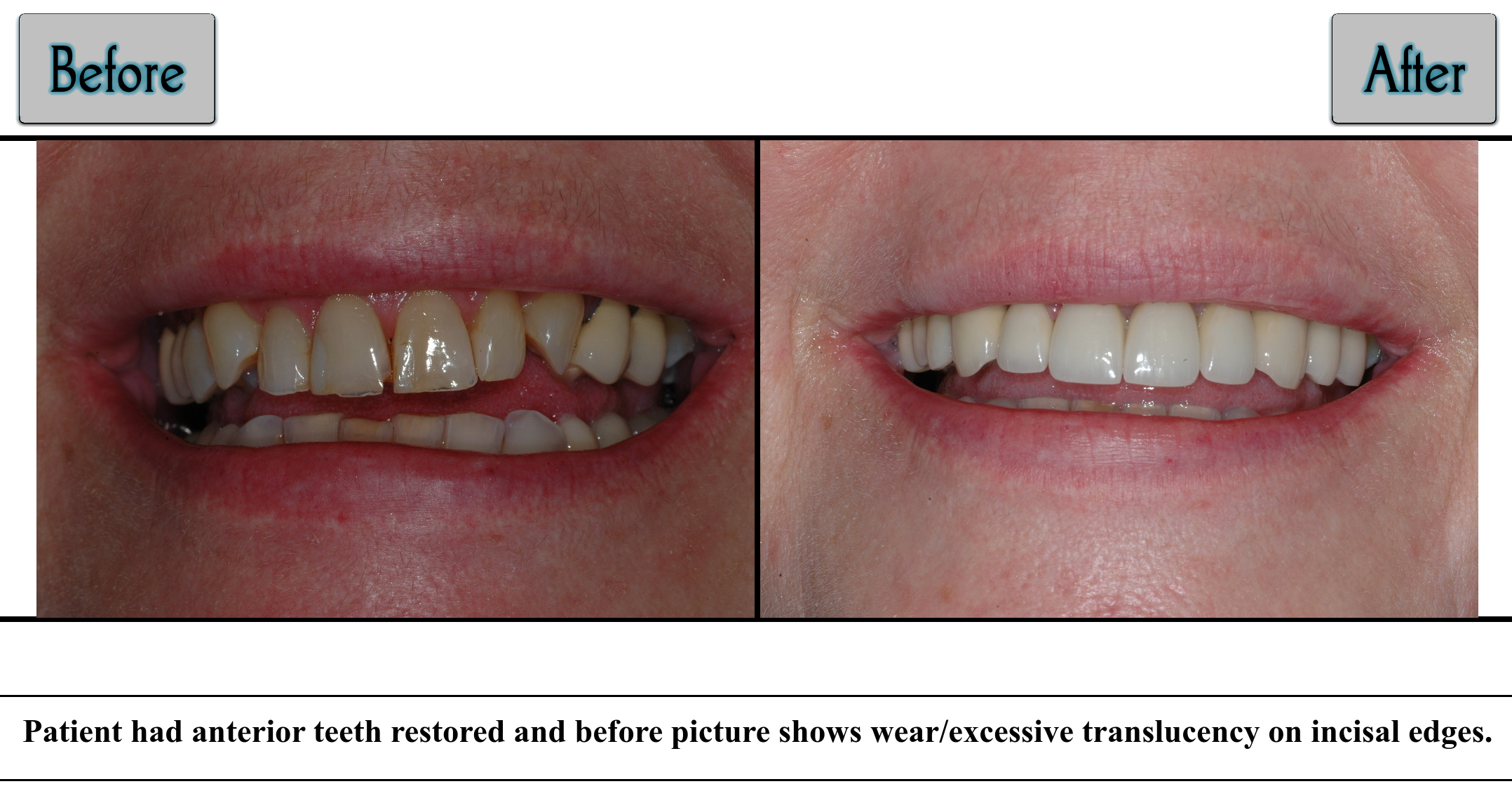 Smile Gallery | DMS Dentistry